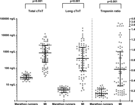 Composition of cardiac troponin release differs after marathon running ...