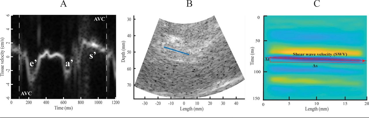 Ultrafast ultrasound shear wave elastography: a novel approach for ...